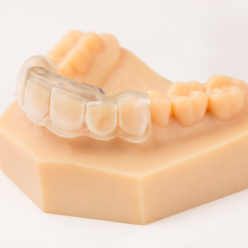 Astron CLEARsplint – Studio32 Dental Laboratory