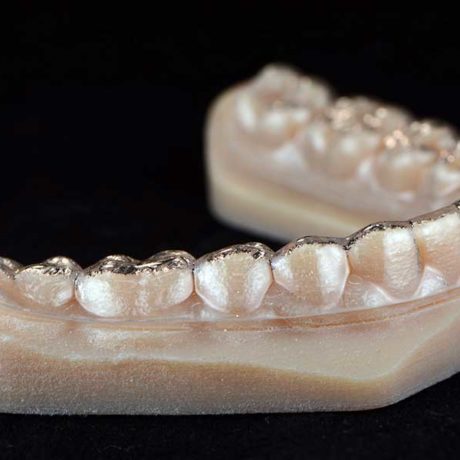 Hawley/Invisible Retainers – Studio32 Dental Laboratory